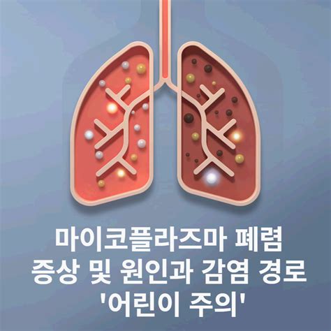 마이코플라즈마 폐렴 증상 및 원인과 감염 경로 어린이 주의 무료 건강 가이드 블로그