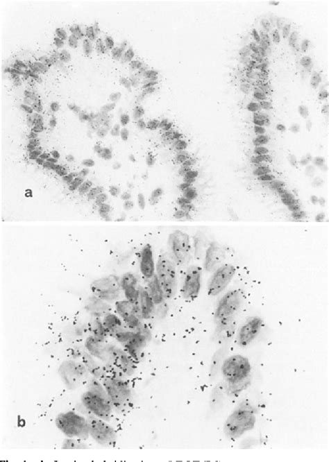 Figure 4 From Localization Of Epidermal Growth Factor Transforming Growth Factor Receptor In
