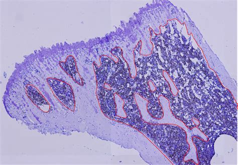 Best Way To Draw Consistent Roiannotations For Bone Marrow Regions In