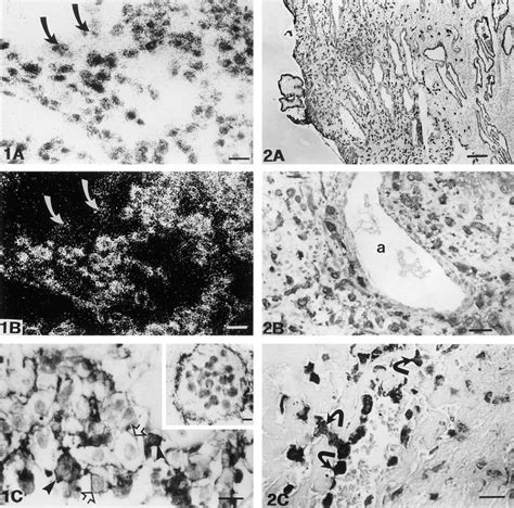 A B Intermediate Trophoblasts Of The Trophoblastic Shell A And Download Scientific Diagram