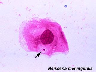Fileneisseria Meningitidis2 Embryology