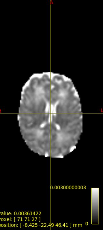 Mrview Intensity Scaling Mrtrix3 Community