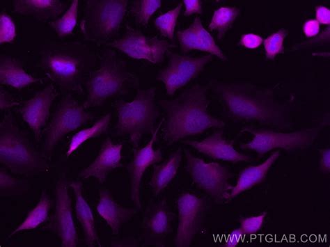 Thymidylate Synthase Antibody Cl647 15047 Proteintech