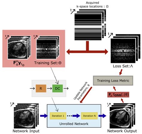 Deep Learning Based Reconstruction For Cardiac Mri A Review