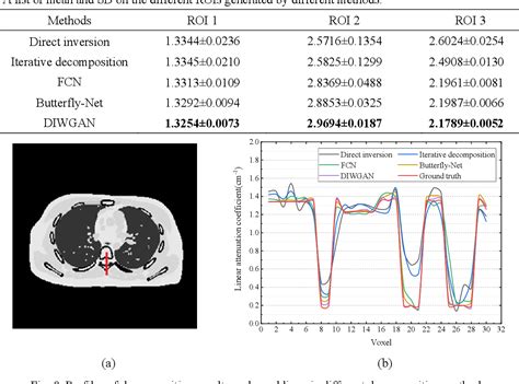 Table 3 From A Material Decomposition Method For Dual Energy Ct Via Dual Interactive Wasserstein