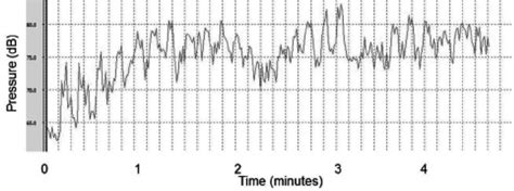 Equivalent Sound Level Of Classical Musical Auditory Stimulation Db Download Scientific