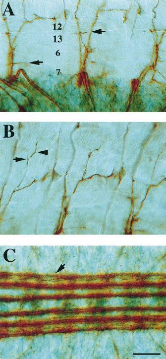 Neuronal Sema I Rescues The Motor Axon And Cns Pathfinding Defects In