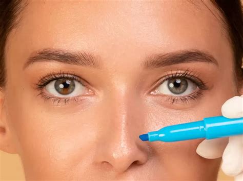 What Are Rhinoplasty Techniques Is There Non Surgical Rhinoplasty