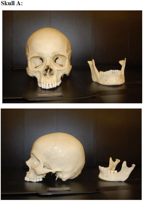 Solved Identify The Sex What Specific Chegg Com