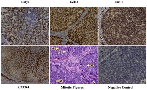 Morphoproteomics And Biomedical Analytics Identify The C Myc Ezh2 Sirt1 And Cxcr4 Pathways As