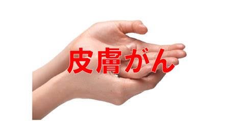 皮膚がんの治療手術数が多い病院