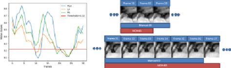 Figure 1 From Automatic Cardiac Resting Phase Detection For Static Cardiac Imaging Using Deep