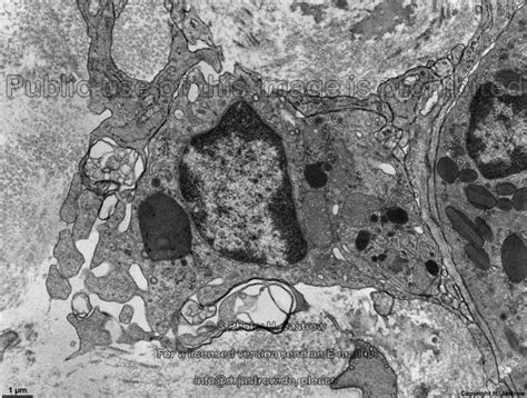 Lysosomes Drjastrows Electron Microscopic Atlas