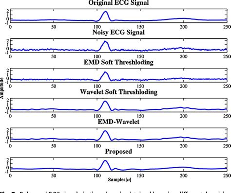 Figure 8 From Denoising Of Ecg Signals Based On Noise Reduction