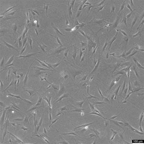 Bj Fibroblast Cells