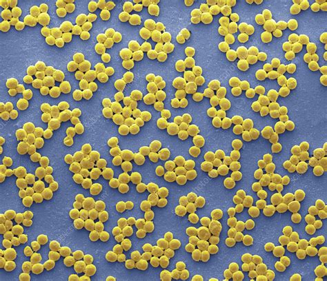 Group A Streptococcus Bacteria Sem Stock Image C Science Photo Library
