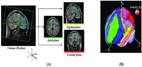 Part A Is The Anatomical Coordinate System Acs The Sagittal Plane