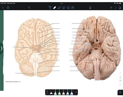 Diencephalon Anatomy Quiz