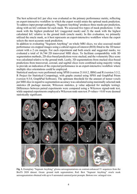 The Segment Anything Foundation Model Achieves Favorable Brain Tumor Autosegmentation Accuracy
