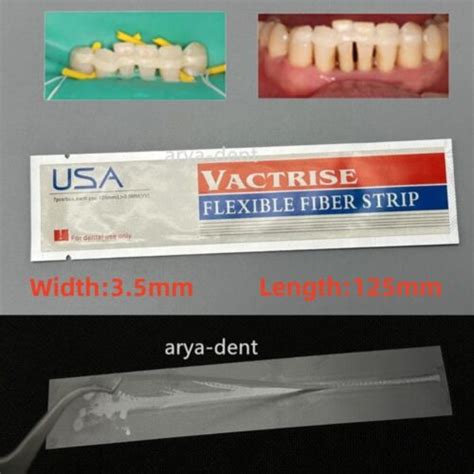 Dental Ribbond Type Glass Fiber Splint Light Cure Composite Resin Bonding Strip Ebay