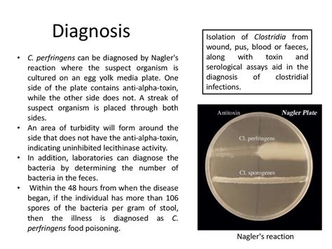 Clostridium Perfringens презентация онлайн Clostridium Perfringens презентация онлайн