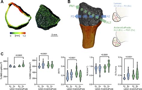 Figure 3 From Superior Bone Microarchitecture In Anatomic Versus Nonanatomic Fibular Drill