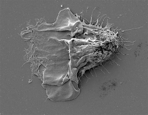 Jose Luis Torres Cuadros On Linkedin Single Cell Transcriptional