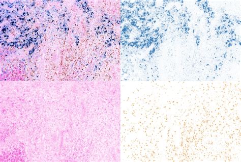 ᴗ• Qupath Scripting 6 Customized 3 Stain Color Deconvolution Usage And Issues Imagesc Forum