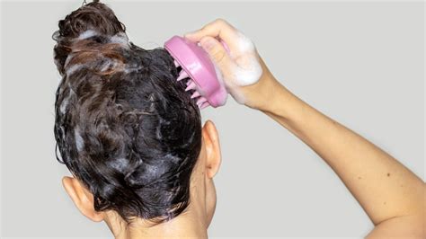 DIY Ways To Get Rid Of Dandruff For Good