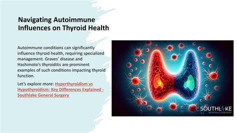 Hyperthyroidism Vs Hypothyroidism Explained Concisely Pdf Thyroid Disorders Endocrine And