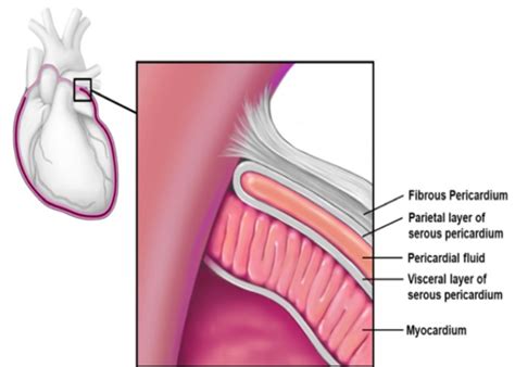 Pericardial Diseases And Cardiac Trauma Flashcards Quizlet