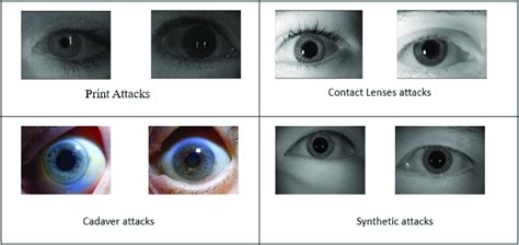 Different Types Of Iris Spoofing Attacks Print Attacks 32 Contact
