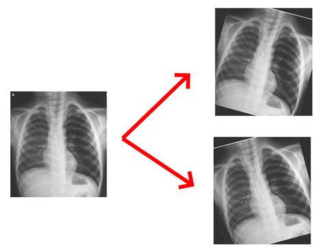 Sistem Deteksi COVID Dengan TensorFlow Dan Deep Learning Teknonerdy Learning Is EZ