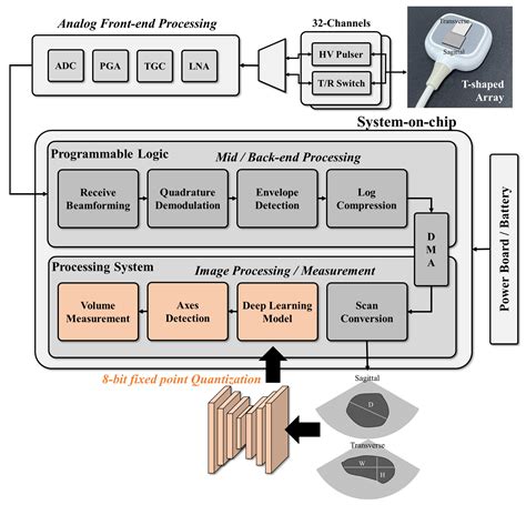 A Lightweight Deep Learning Network On A System On Chip For Wearable Ultrasound Bladder Volume