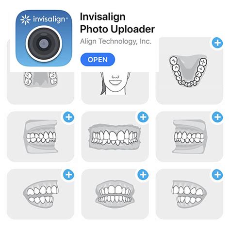 Invisalign Clear Aligners By Bidh Thailands Invisalign Award Clinic