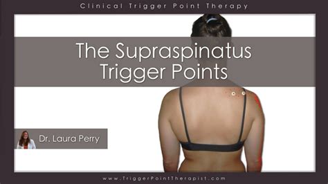 Supraspinatus Triggerpoint Online Emergencydentistry Com