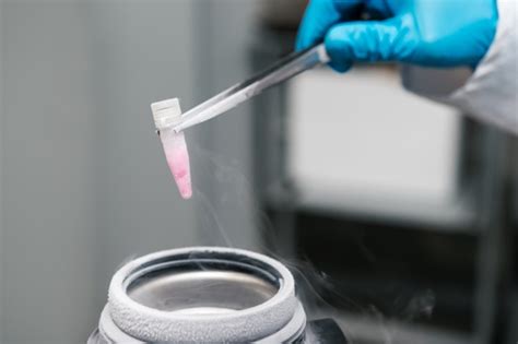 Considerations For Using Cryopreserved Pbmcs Versus Fresh