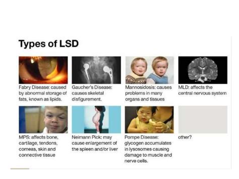 Approach To Inborn Errors Of Metabolism Pptx