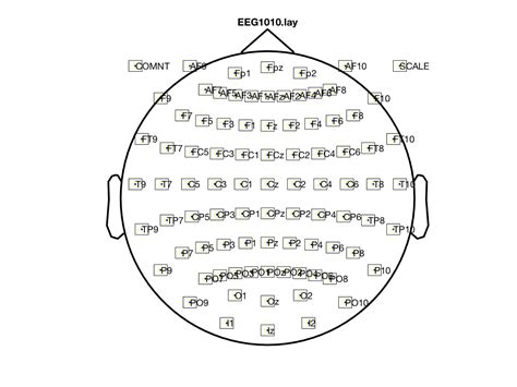 q why eletrode positions plot is different from other tools like fieldtrip · issue 4880 · mne