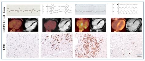 Examples Of Diagnostic Findings In Patients With Cs Fulfillment Of Download Scientific Diagram
