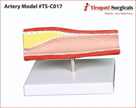 Artery Model Ts C017 At Best Price In Pune By Tirupati Surgicals Id