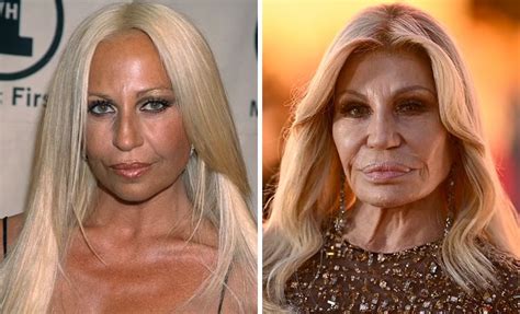 The Worst Thing That I Ever Did” 19 Celebrities Before And After