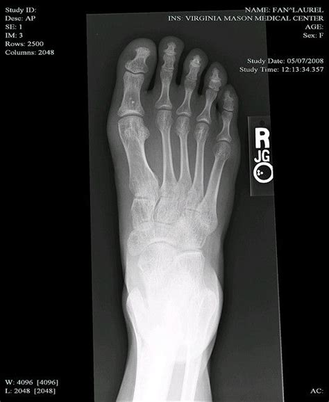 Foot X Ray Dramatic Play Preschool Human Body Science Community Helpers Preschool