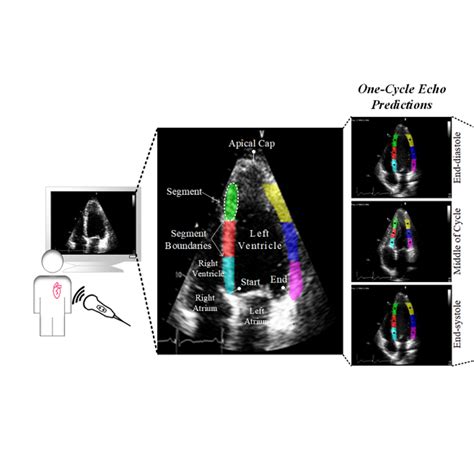 Hmc Qu Dataset Kaggle