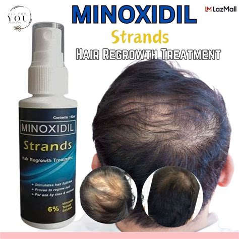 Original Minoxidil Hair Regrowth Treatment 6 Stimulate Hair Growth