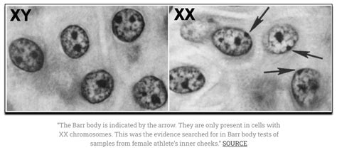 The Convoluted History Of Sex Testing In The Olympics Why Evolution