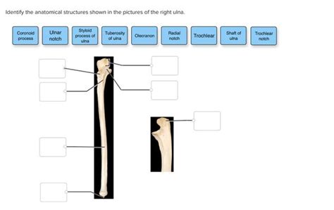 Solved Identify The Anatomical Structures Shown In The