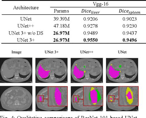 Pdf Unet 3 A Full Scale Connected Unet For Medical Image Segmentation Semantic Scholar