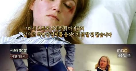 서프라이즈 하반신 마비 모니크 세 번의 사고 후 기적