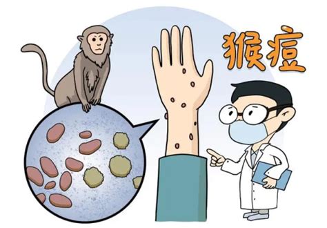 猴痘应该怎样预防？北京疾控提示北京日报网